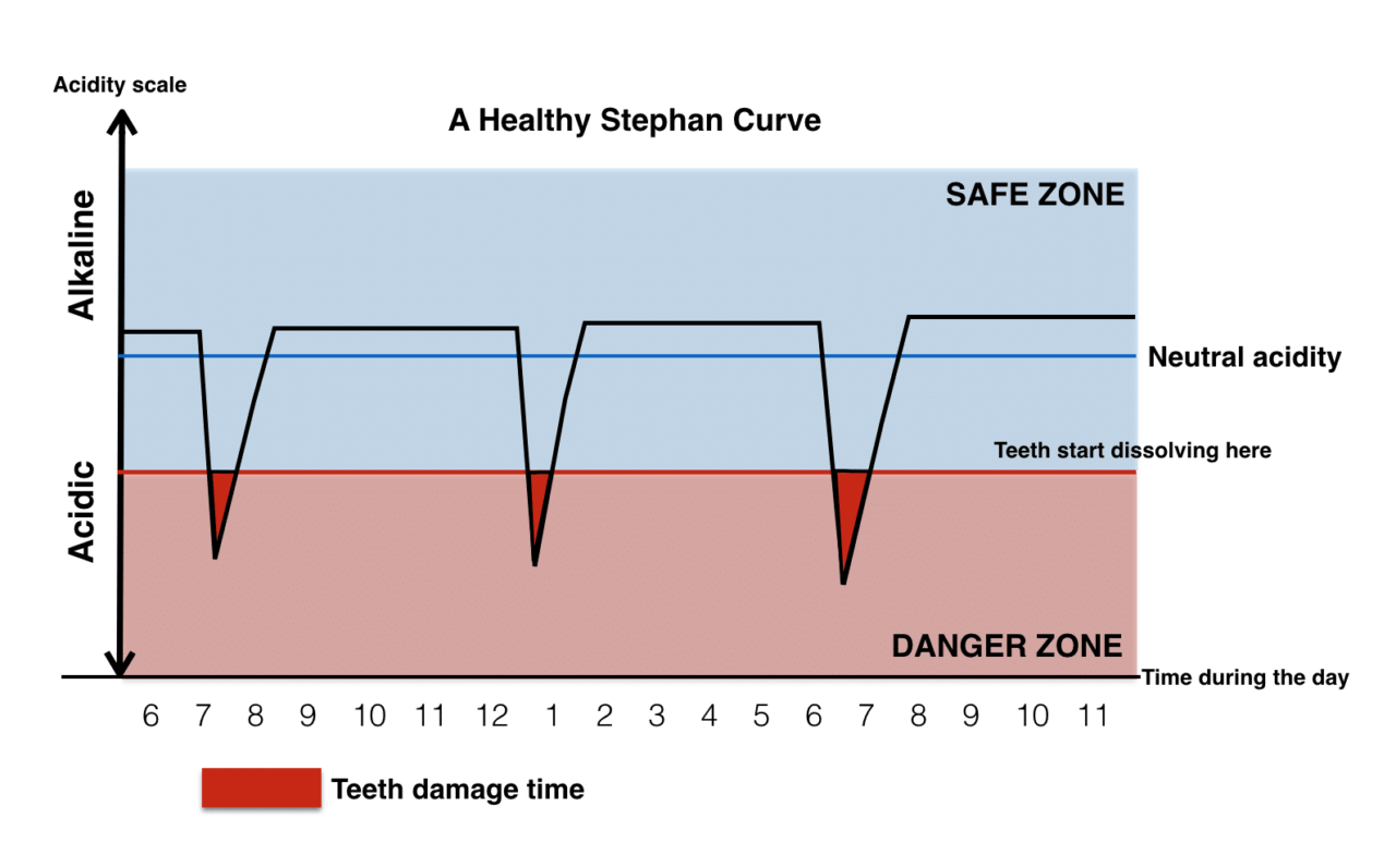 Why some people get holes in their teeth and others don’t | Supa Dental ...