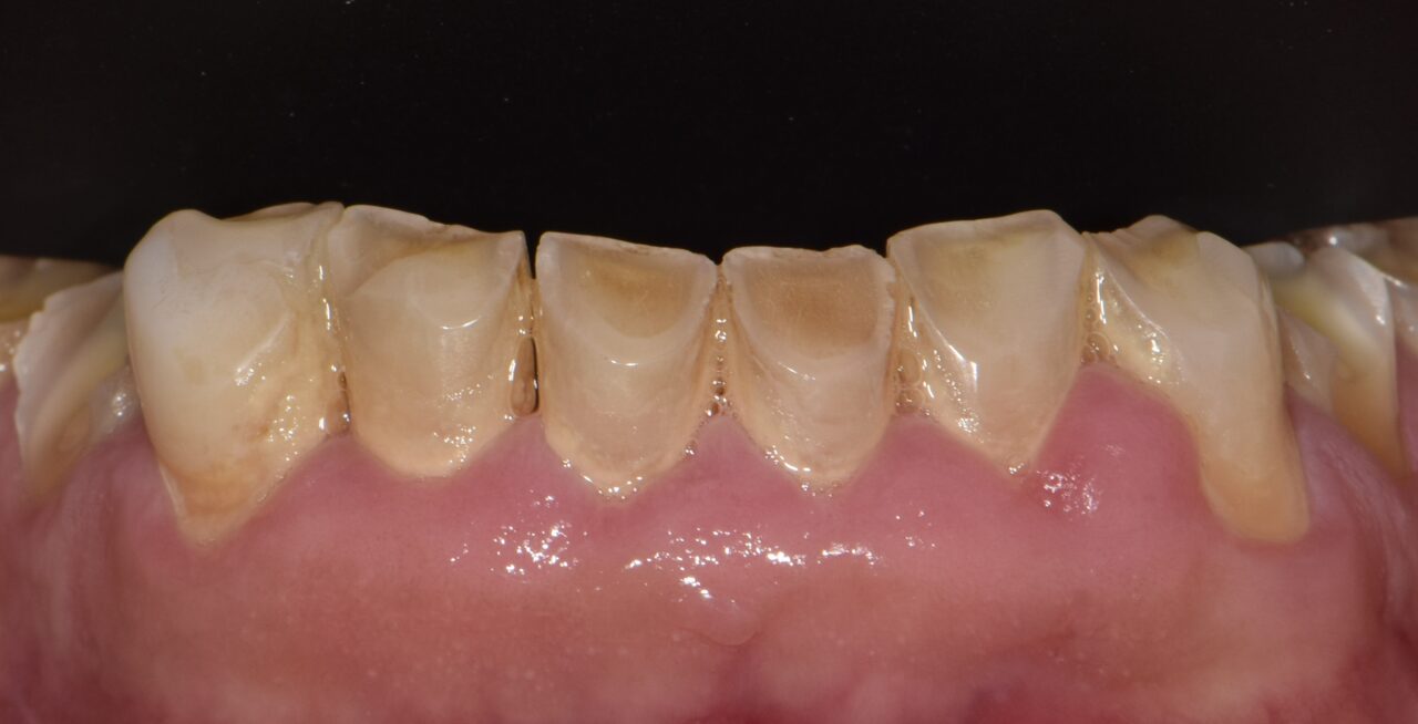 Smile Gallery Supa Dental | Melton Dentist | Melton Dental