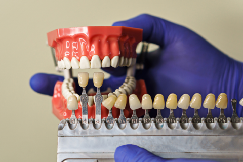 Teeth Whitening Melton | Melton Dentist | Supa Dental